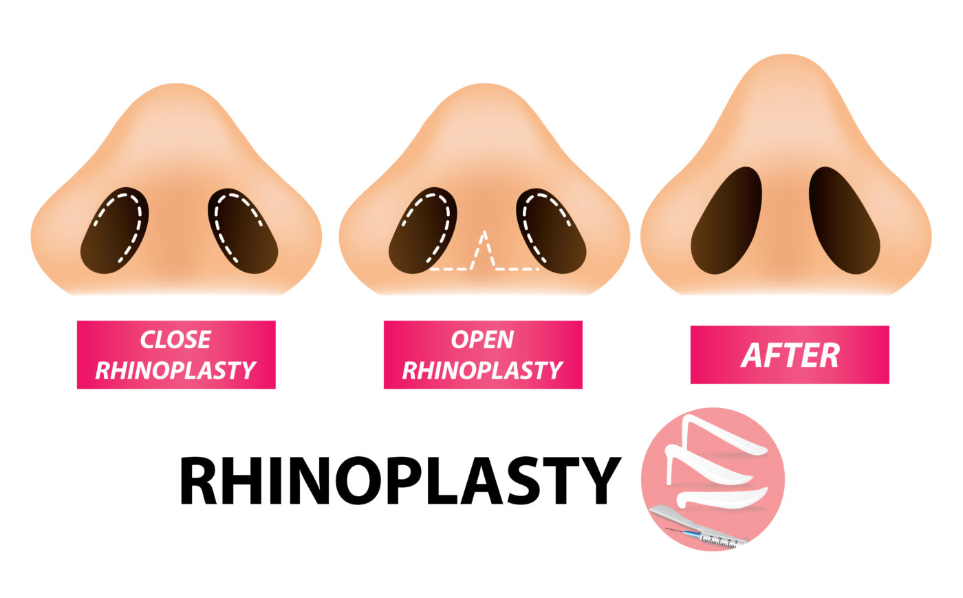 The Rhinoplasty Clinic Philadelphia, PA | Glen Mills Rhinoplasty Clinic