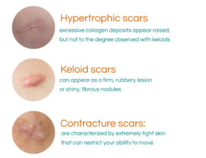 Scar Revision in Philadelphia, PA | Providence Cosmetic Surgery